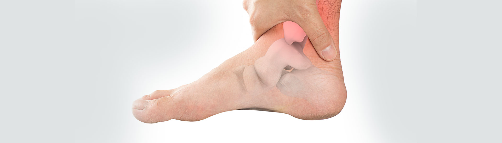 Foot & Ankle Orthopedic Surgery in Washington DC, Virginia, Maryland